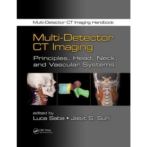 Multi-Detector CT Imaging: Principles Head Neck and Vascular Systems ...