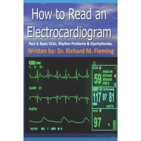 How to Read an Electrocardiogram - Part 3: Basic ECGs Rhythm Problems ...