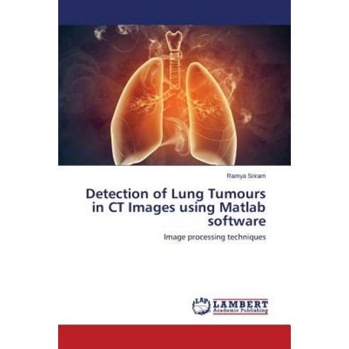 Detection of Lung Tumours in CT Images Using MATLAB Software Paperback, LAP Lam