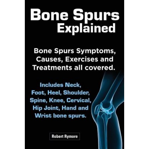 Bone Spurs Explained. Bone Spurs Symptoms Causes Exercises and ...
